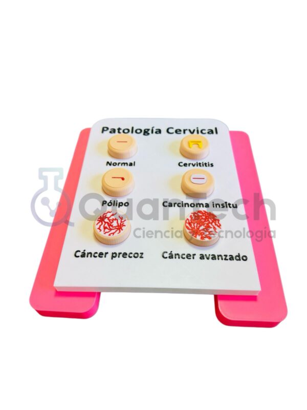 MODELO ANATOMICO PATOLOGIA CERVICAL COMPLETO – Quantech