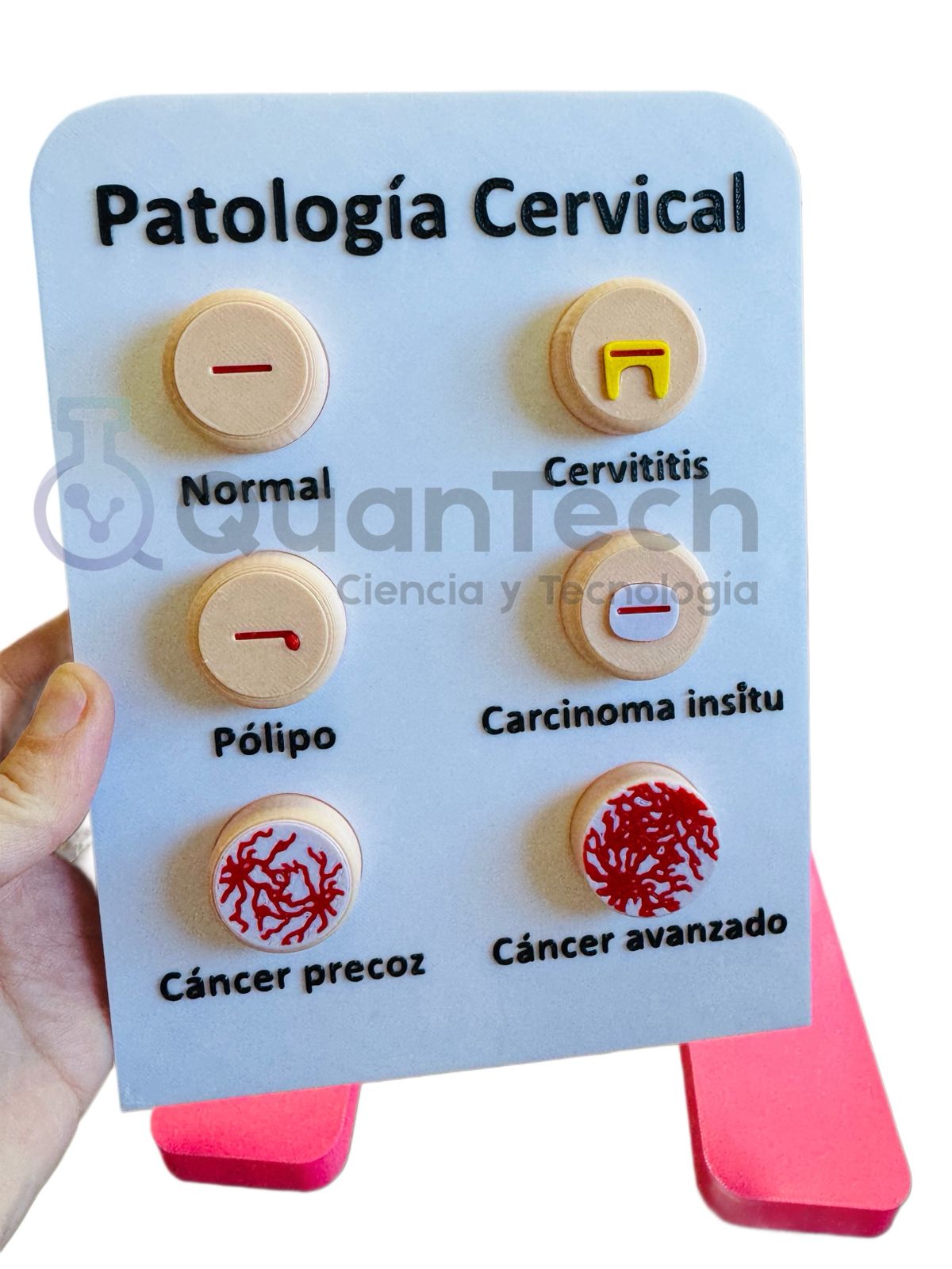 MODELO ANATOMICO PATOLOGIA CERVICAL COMPLETO – Quantech
