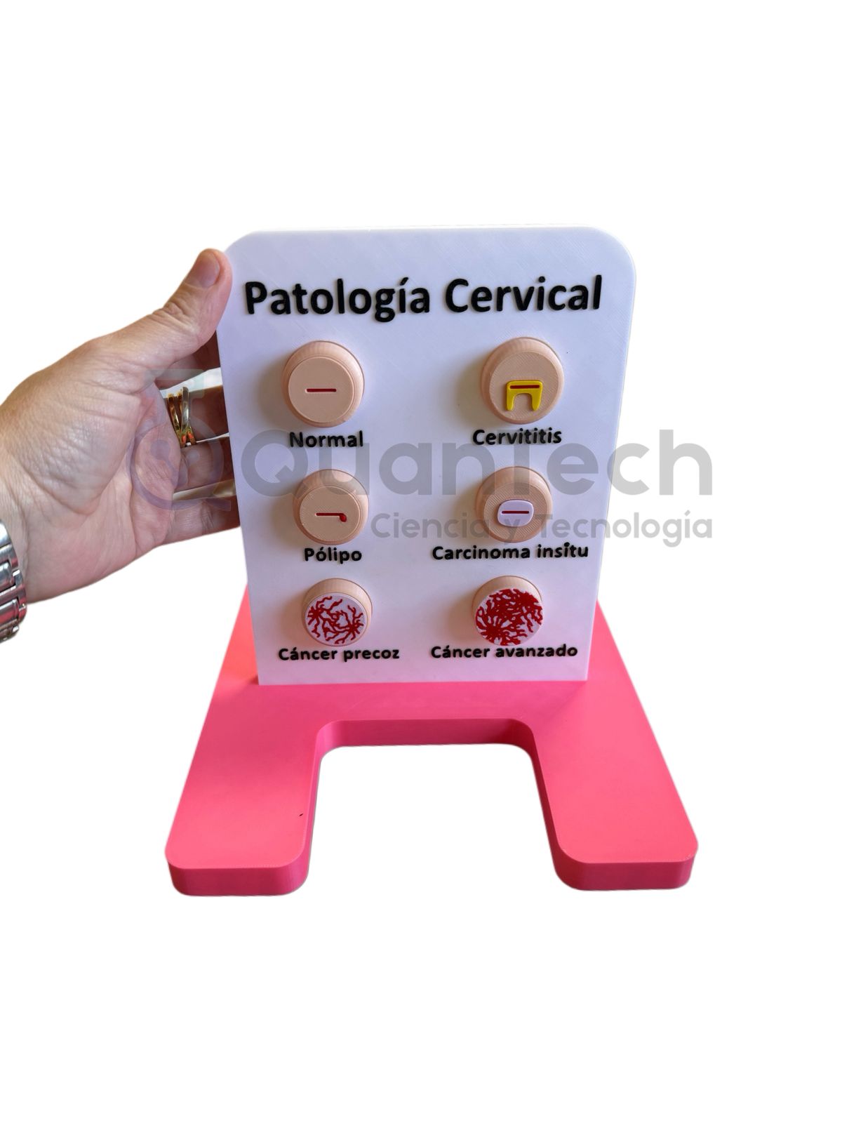 MODELO ANATOMICO PATOLOGIA CERVICAL COMPLETO – Quantech
