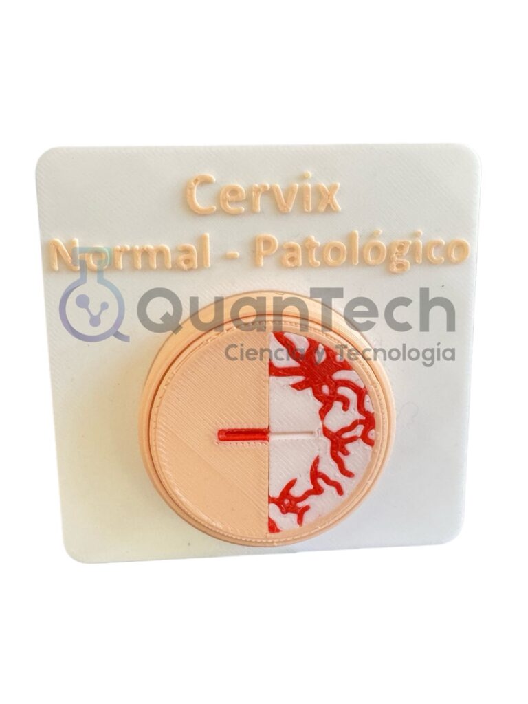 MODELO ANATOMICO CERVIX NORMAL-PATOLOGICO – Quantech